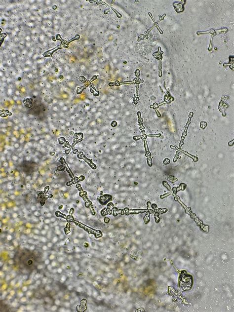 A Sign From God Or Just Something Interesting Microscopically R Microscopy