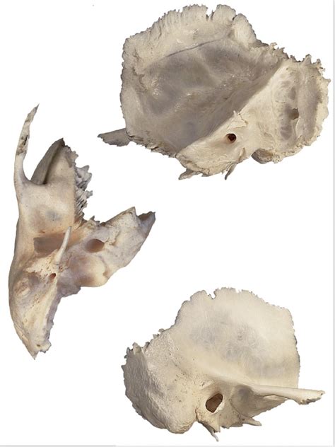 Temporal Bone Diagram Quizlet