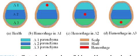 Figure 6 From Classification Of Hemorrhage Using Priori Information Of Electrode Arrangement