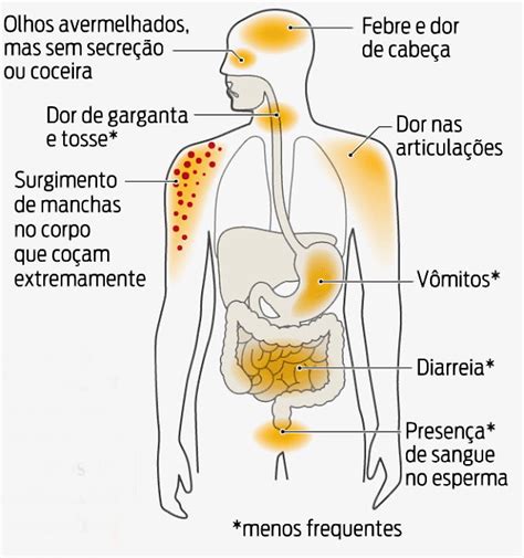 Zika Transmissão Sintomas E Tratamento Toda Matéria
