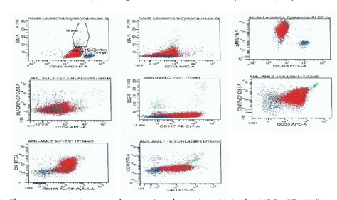 Figure 2 From Eccentricity Of Acute Myeloid Leukemia With Npm1 And Flt3 Itd Mutation A Case