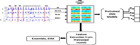 Figure 1 From Classification Of Atrial Fibrillation With Pre Trained Convolutional Neural