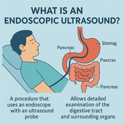 Endoscopic Ultrasound Eus Melbourne Advanced Gi Diagnostics