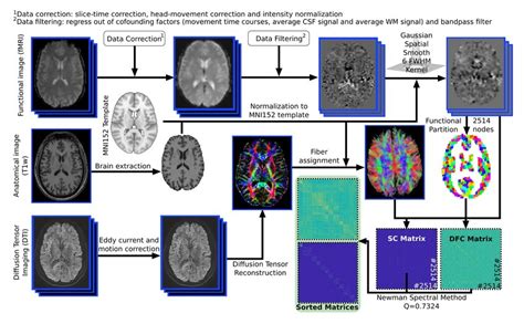 Neuroimage Preprocessing Pipeline Triple Acquisitions Were Performed