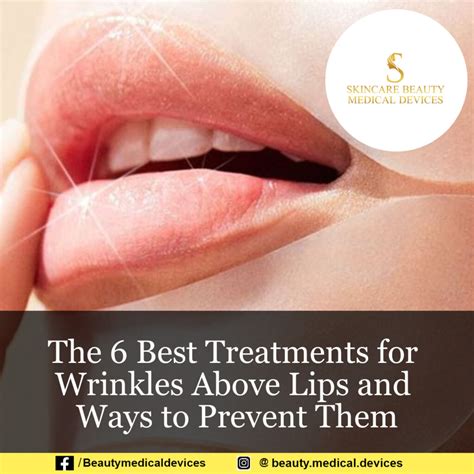 Best Treatments For Wrinkles Above Lips—plus Ways To Prevent Them