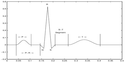 Decomposition Of The Ecg Waveform Download Scientific Diagram