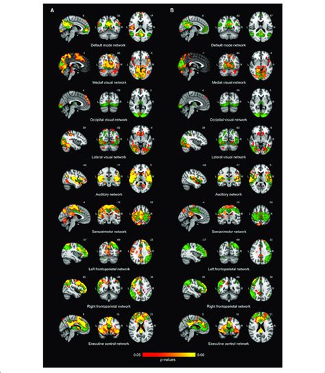 Differences In Network Connectivity Between Young And Older Adults Download Scientific