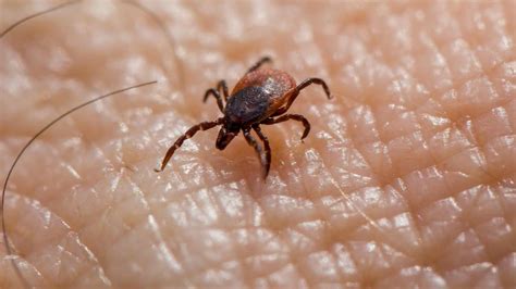 Lyme Disease What You Need To Know About The Cause Symptoms And Prevention