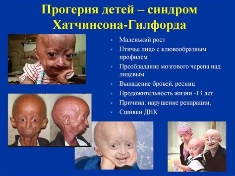 Генные болезни человека связанные с нарушением систем репарации презентация онлайн