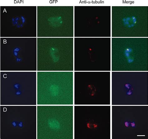 Colocalization Experiments Of Pfark 1gfp With α Tubulin Fluorescence Download Scientific