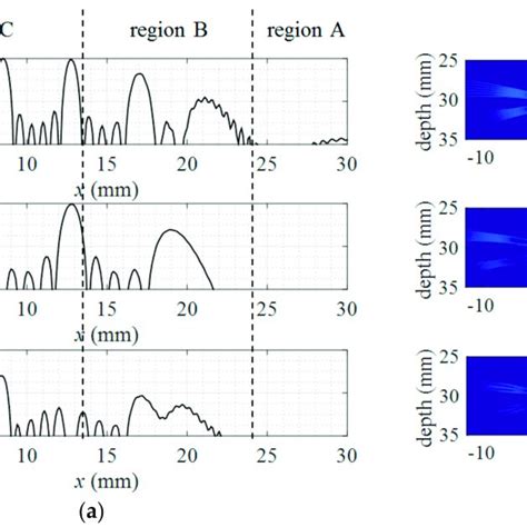 Pdf Methods For Grating Lobe Suppression In Ultrasound Plane Wave Imaging