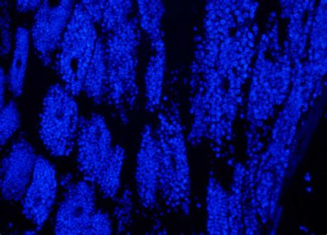 Corn Grain Thin Section Nikons Microscopyu