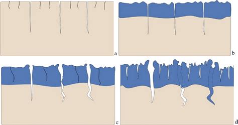 Scheme Of Contribution Of Surface Tension In Suppression Of Droplets Download Scientific