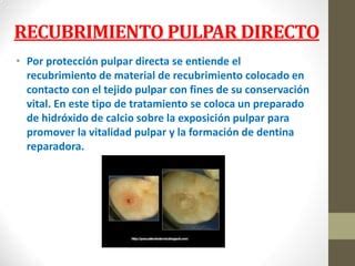 Recubrimiento Pulpar Pdf