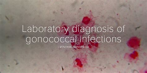 Laboratory Diagnosis Of Gonococcal Infections