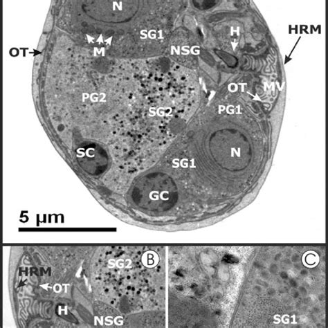 Schematic Diagram Of A Taeniid Oncosphere Illustrating The Structure Download Scientific