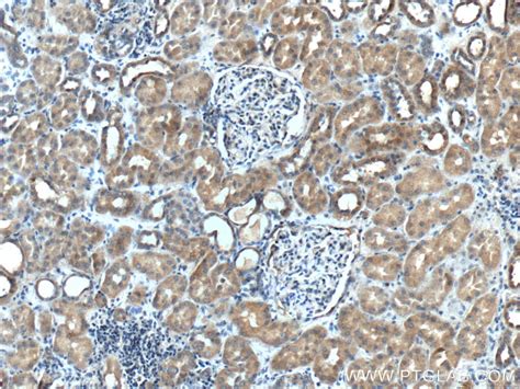 Ddr1 Antibody 10536 1 Ap