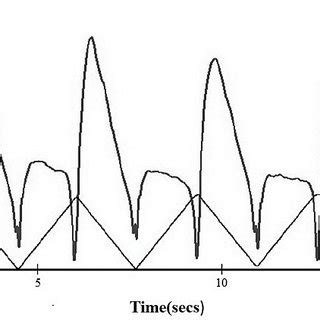 Torque Angle Records Of One Subject At An Angular Velocity Of S Download Scientific Diagram