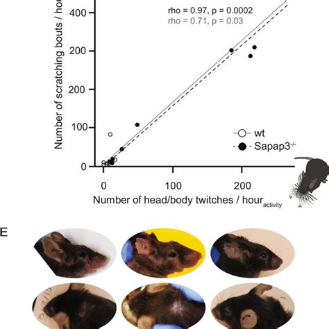 Sapap3− − Mice Express Aberrant Head Body Twitches And Scratching Download Scientific Diagram