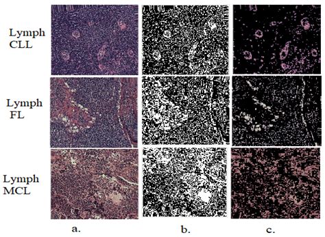 Hybrid Models Based On Fusion Features Of A Cnn And Handcrafted