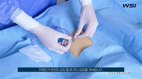 Wsi On Linkedin Kimal Picc Piccguidevideo Howtousekimalpicc Kimalpicc Wsi 더블유에스아이