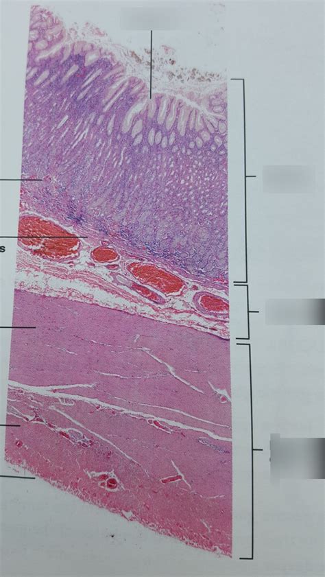 Stomach Histology Diagram Quizlet Stomach Histology Diagram Quizlet
