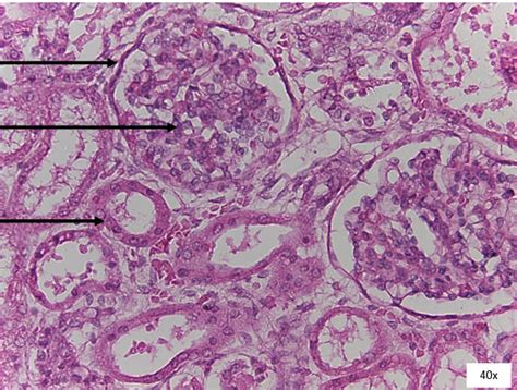 Simple Squamous Epithelium And Simple Cubodial Epithelium Diagram Quizlet