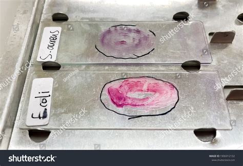 Gram Stain Slide Solved Review The Steps Of The Gram Staining