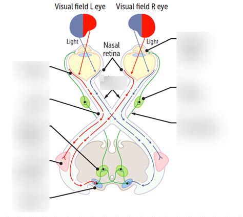 Visual Field Pathway Diagram Quizlet