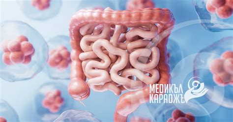 Малко статистика за рака на дебелото черво вероятната 2024