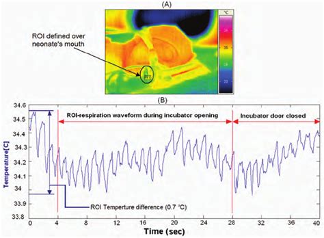 Neonatal Infrared Thermography Imaging A Inside Neonatal Incubator