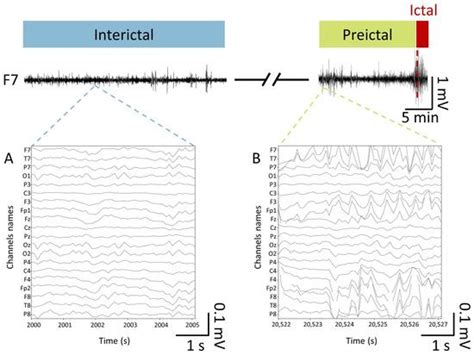 Calibrating Deep Learning Classifiers For Patient Independent