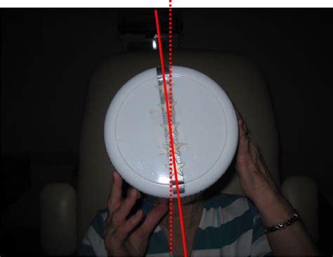 Ocular Lateral Deviation As A Vestibular Sign To Improve Detection Of