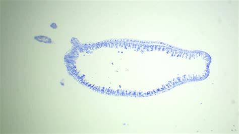 Longitudinal Section Hydra Under Microscope S Stock Footage Video 100 Royalty Free 8910997
