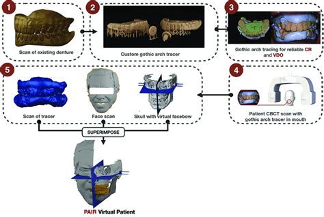 Pair Virtual Patient Workflow For Edentulous Patient Different From