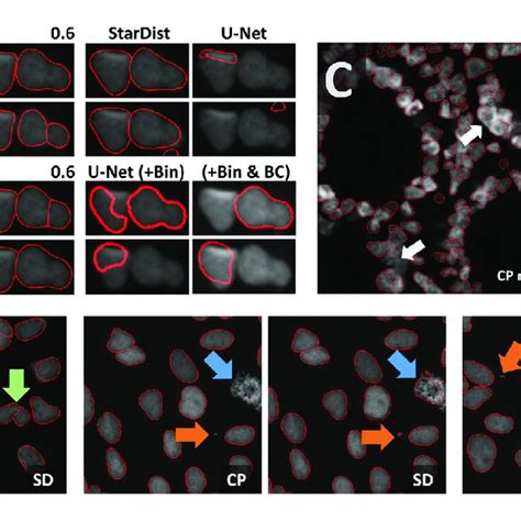 Segmentation Of Dense Fluorescent Nuclei A Segmentation Of The Download Scientific Diagram