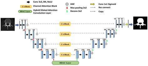Identification Of Vertebrae In Ct Scans For Improved Clinical Outcomes Using Advanced Image