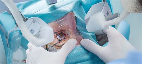 Which Intraocular Lens For Which Patient Healthcare Products