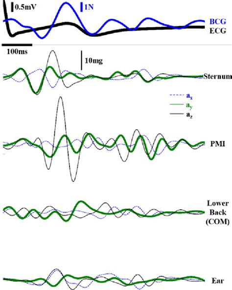Figure 3 From Toward Continuous Noninvasive Assessment Of Ventricular Function And Hemodynamics