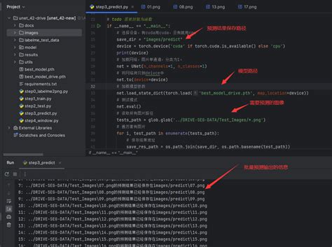 手把手教你用unet做眼底血管图像分割 Unet眼底血管图像分割 Csdn博客