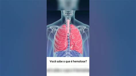 Hematose Youtube