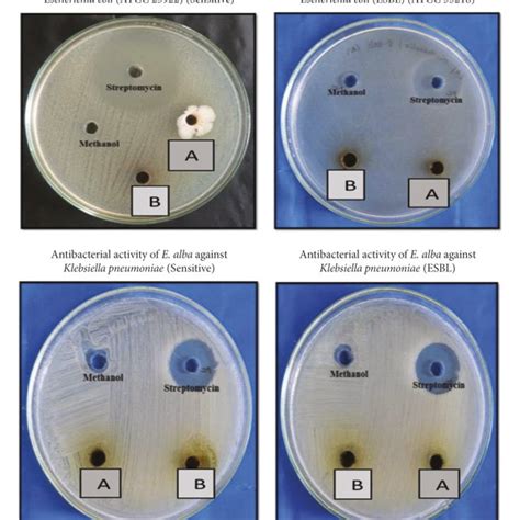 Gc Ms Chromatogram Of Methanolic Extract Of Eclipta Alba Download Scientific Diagram