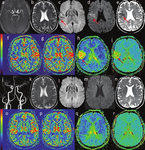 Two Mri Scans From The Same Patient Were Acquired At Different Time