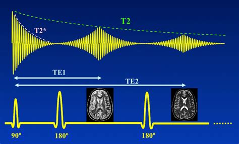 Spin Echo V Fse Questions And Answers In Mri