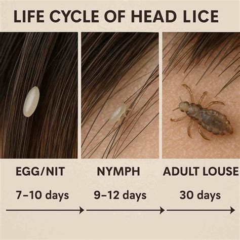 Do Head Lice Live In Bed Linen Learn How To Clean It Dtex Homes