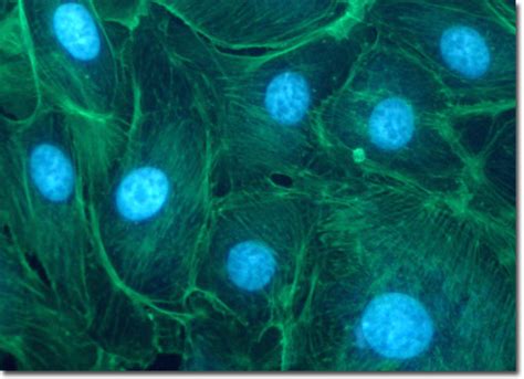 DNA Transfer Ryan Forensic
