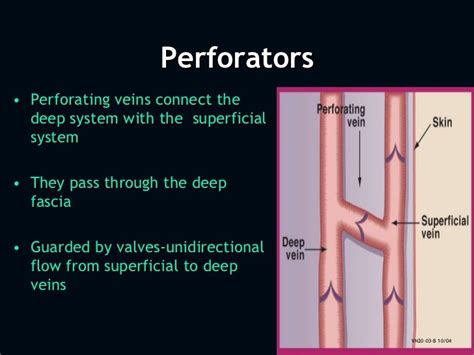 Varicose Veins