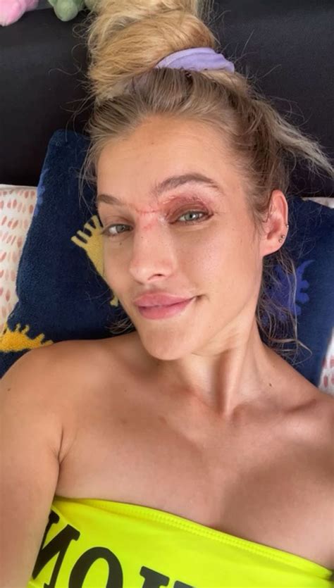 Onlyfans Model Cant Remember Anything From Before Summer 2024