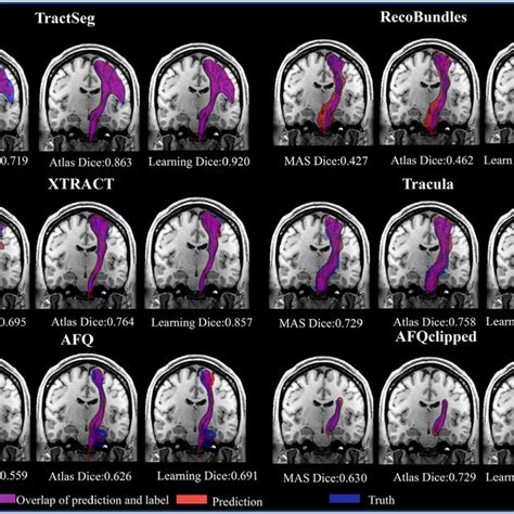 3d Visualization Of Multi Atlas Segmentation Mas Atlas And Download Scientific Diagram