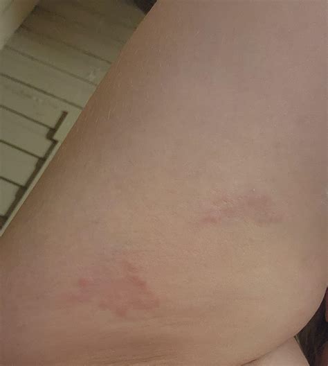 What Are These Spots R Medical